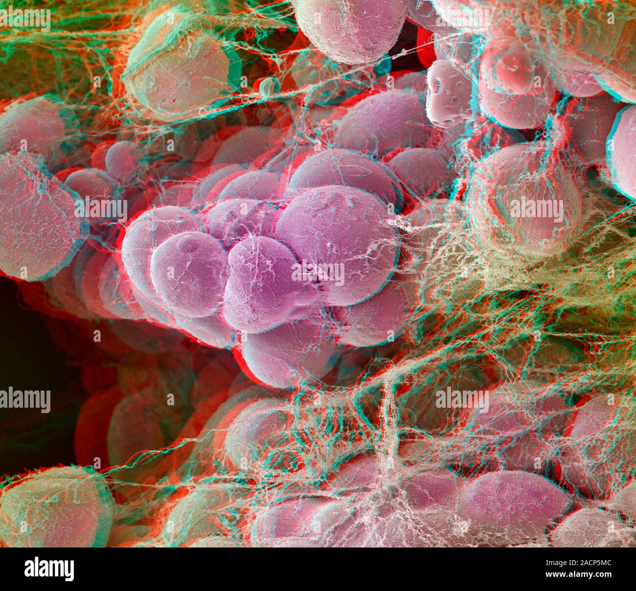 Fat tissue. Coloured stereoscopic (3D) scanning electron micrograph ...