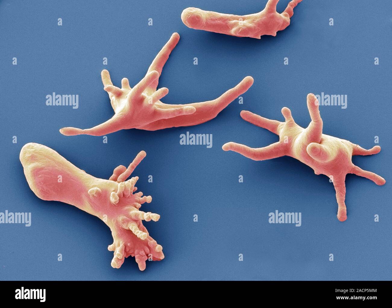 Amoeba protozoa. Coloured scanning electron micrograph (SEM) of four ...