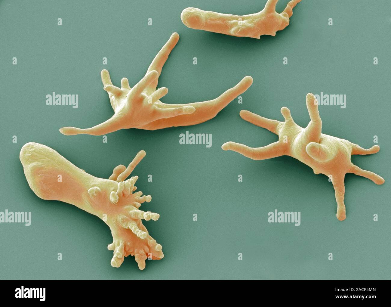 Amoeba protozoa. Coloured scanning electron micrograph (SEM) of four Amoeba sp. protozoa ...
