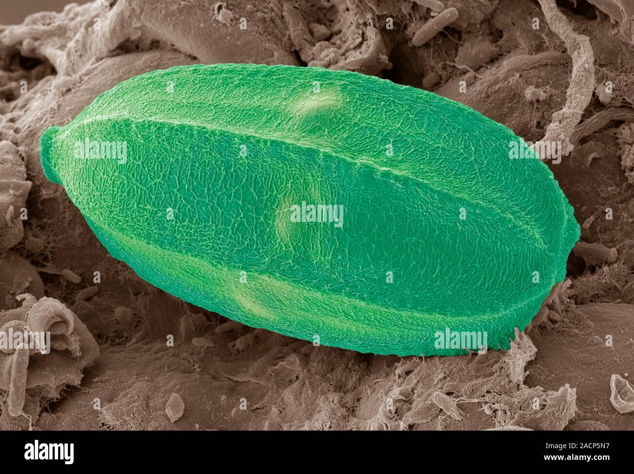 Insect egg. Coloured scanning electron micrograph (SEM) of an insect ...