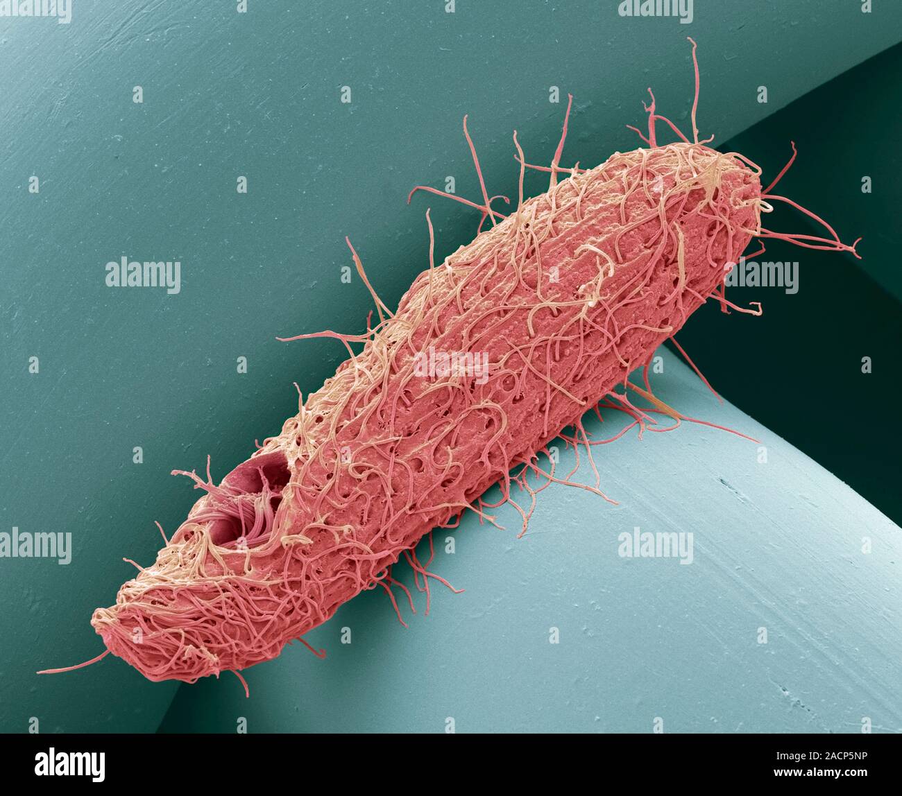Tetrahymena protozoan. Coloured scanning electron micrograph (SEM) of a ...