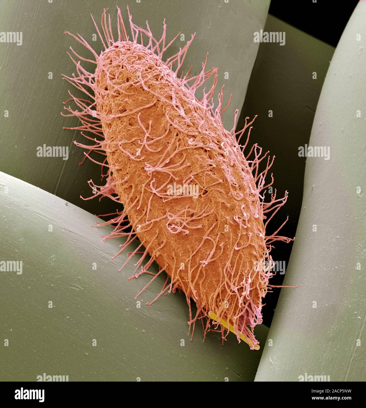 Ciliate protozoan. Coloured scanning electron micrograph (SEM) of a ...