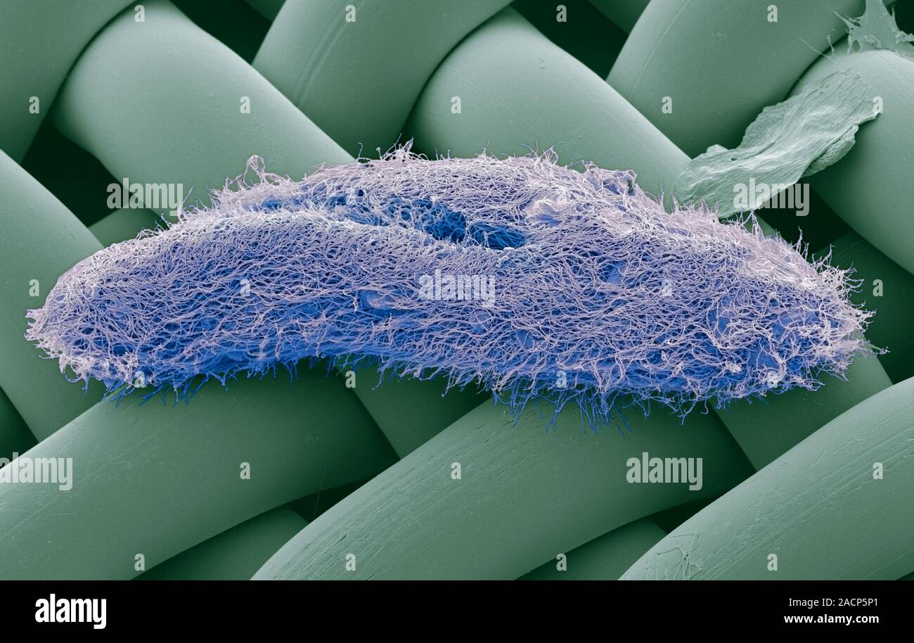 Paramecium protozoan. Coloured scanning electron micrograph (SEM) of a ...