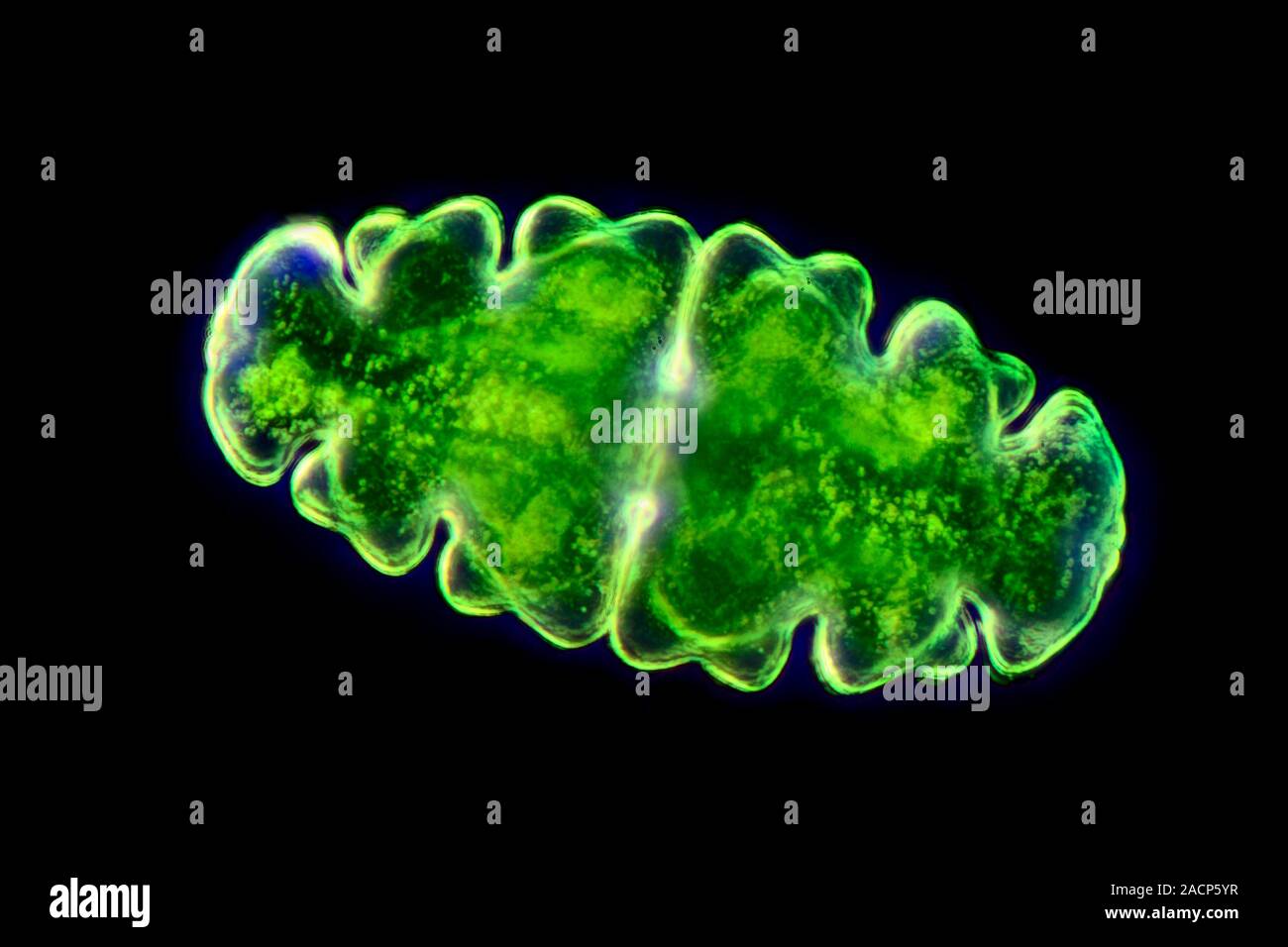 Euastrum desmid. Darkfield illuminated light micrograph of a Euastrum ...