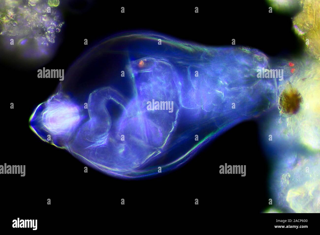 Rotifer. Darkfield illuminated light micrograph of a rotifer (phylum ...