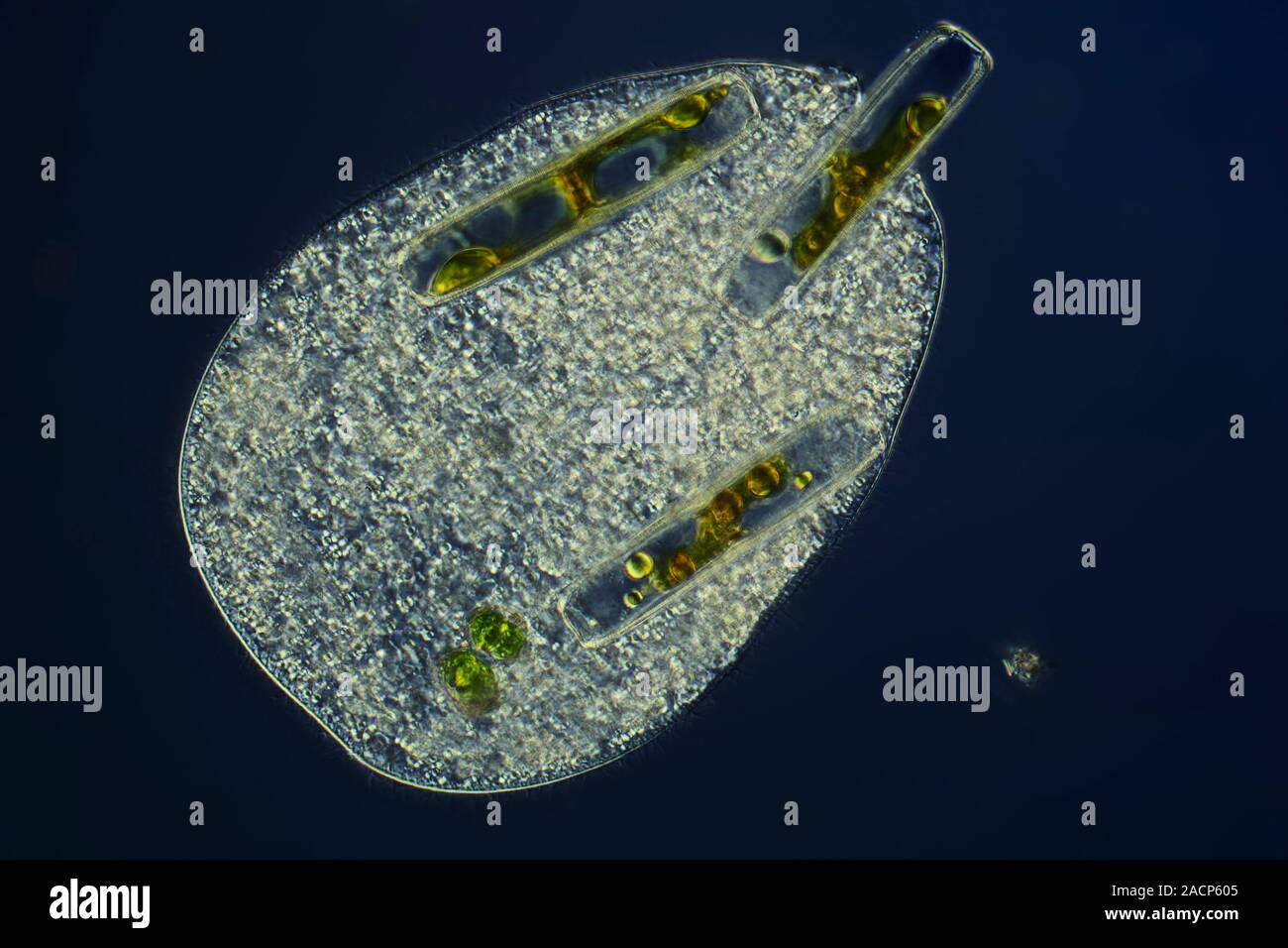 Ciliate protozoan ingesting algae. Darkfield illuminated light ...