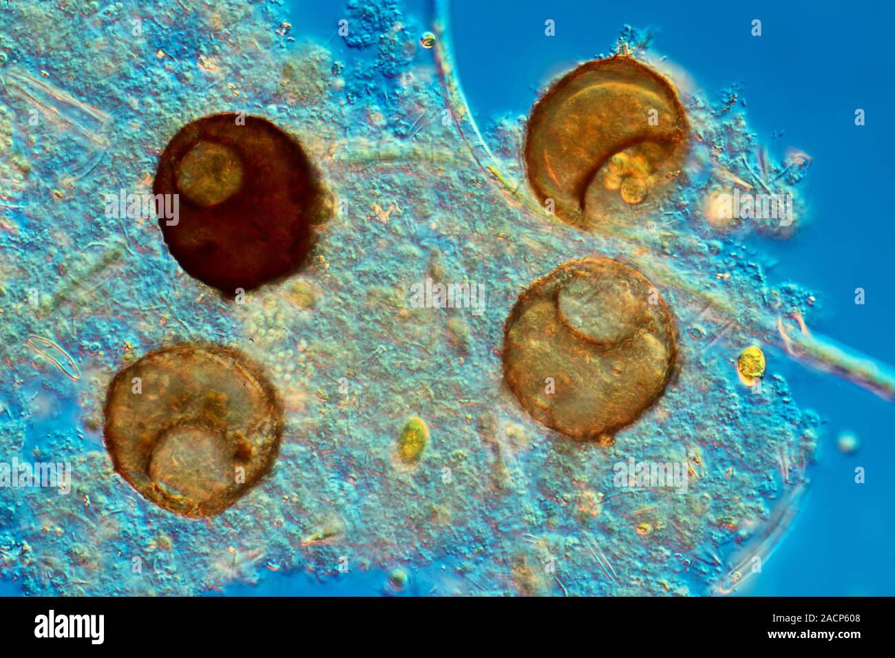 Amoeboid protozoa. Differential interference contrast (DIC) micrograph ...