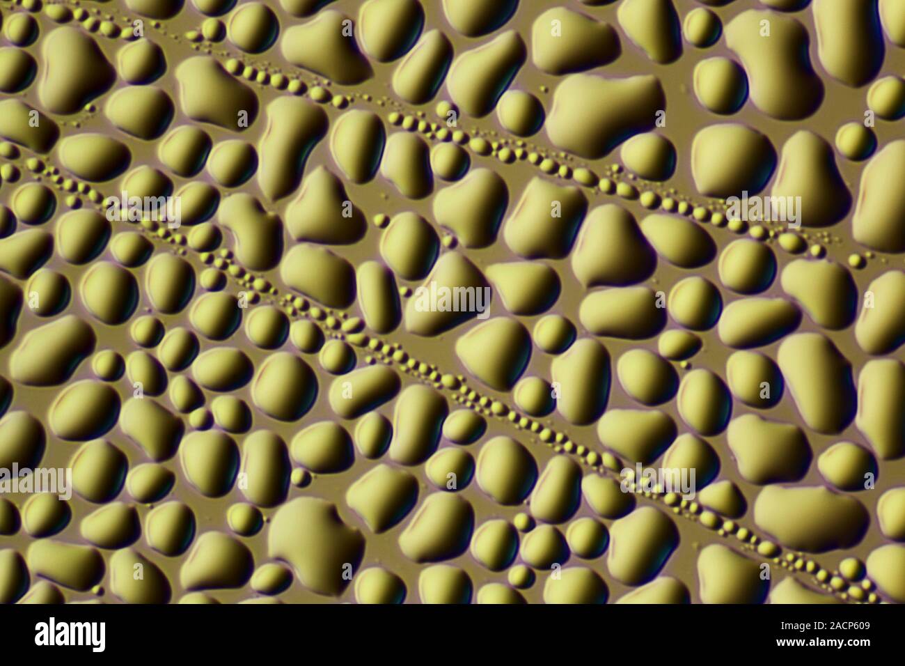 Water droplets, light micrograph. Differential interference contrast ...