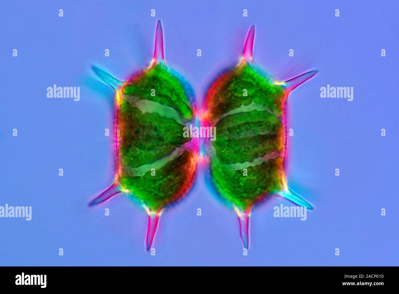 Xanthidium desmids. Polarised light micrograph of a Xanthidium sp ...