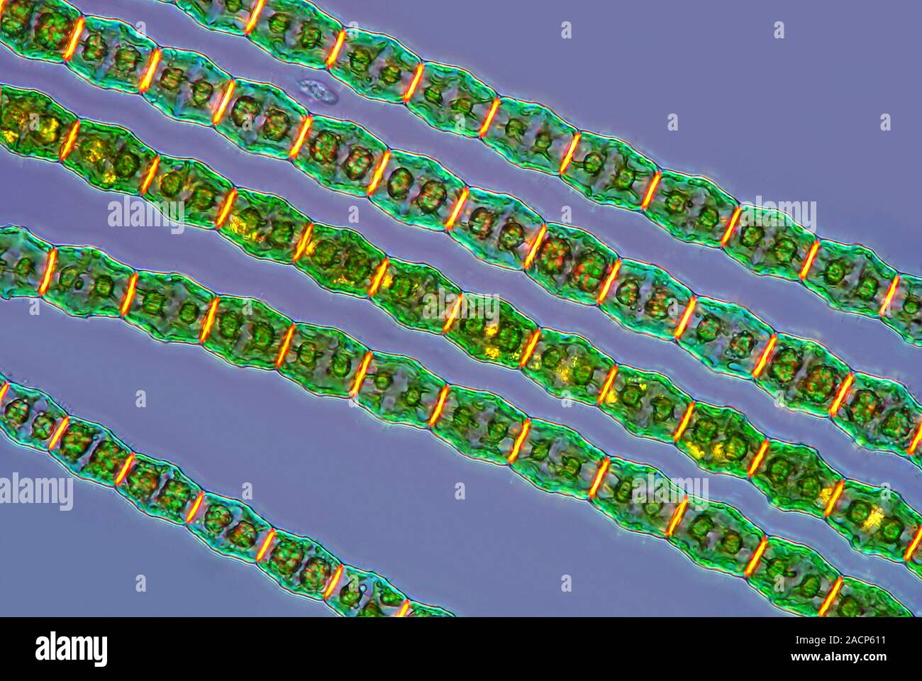 Bambusina desmids. Polarised light micrograph of a colony of Bambusina ...