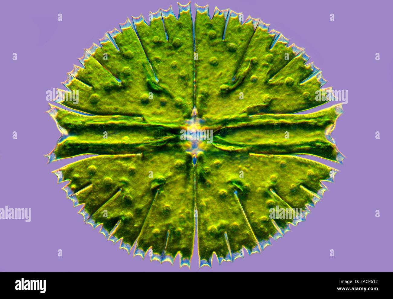 Micrasterias desmid. Polarised light micrograph of a Micrasterias ...