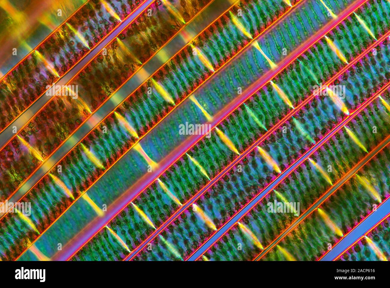 Spirogyra algae. Polarised light micrograph of a colony of Spirogyra sp ... Spirogyra algae. Polarised light micrograph of a colony of Spirogyra sp ...