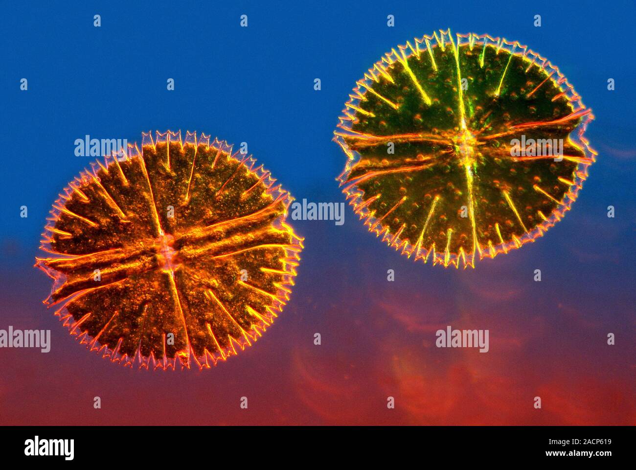 Micrasterias desmids. Rheinberg illuminated light micrograph of ...