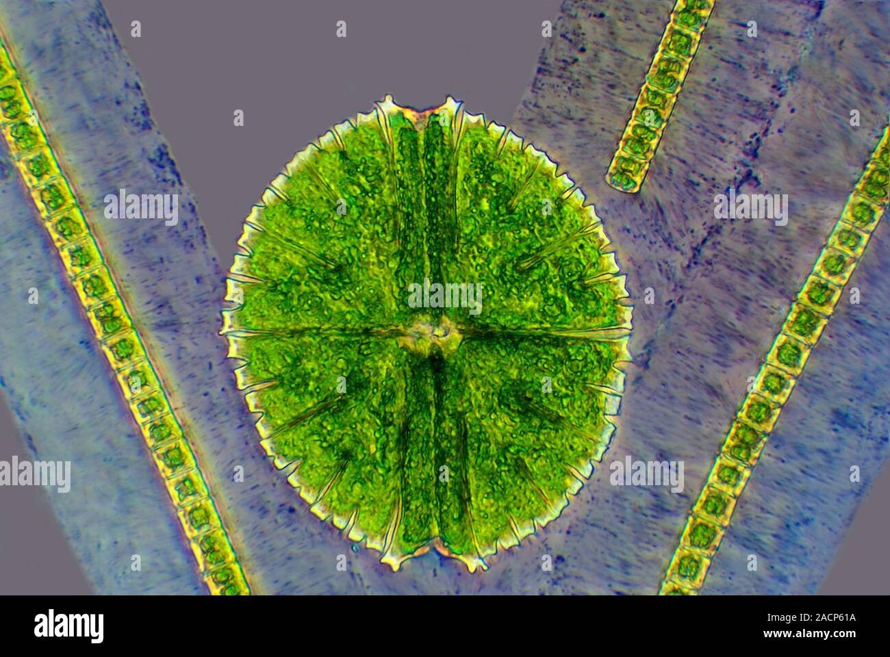 Desmids. Phase contrast light micrograph of Micrasterias sp. and ...