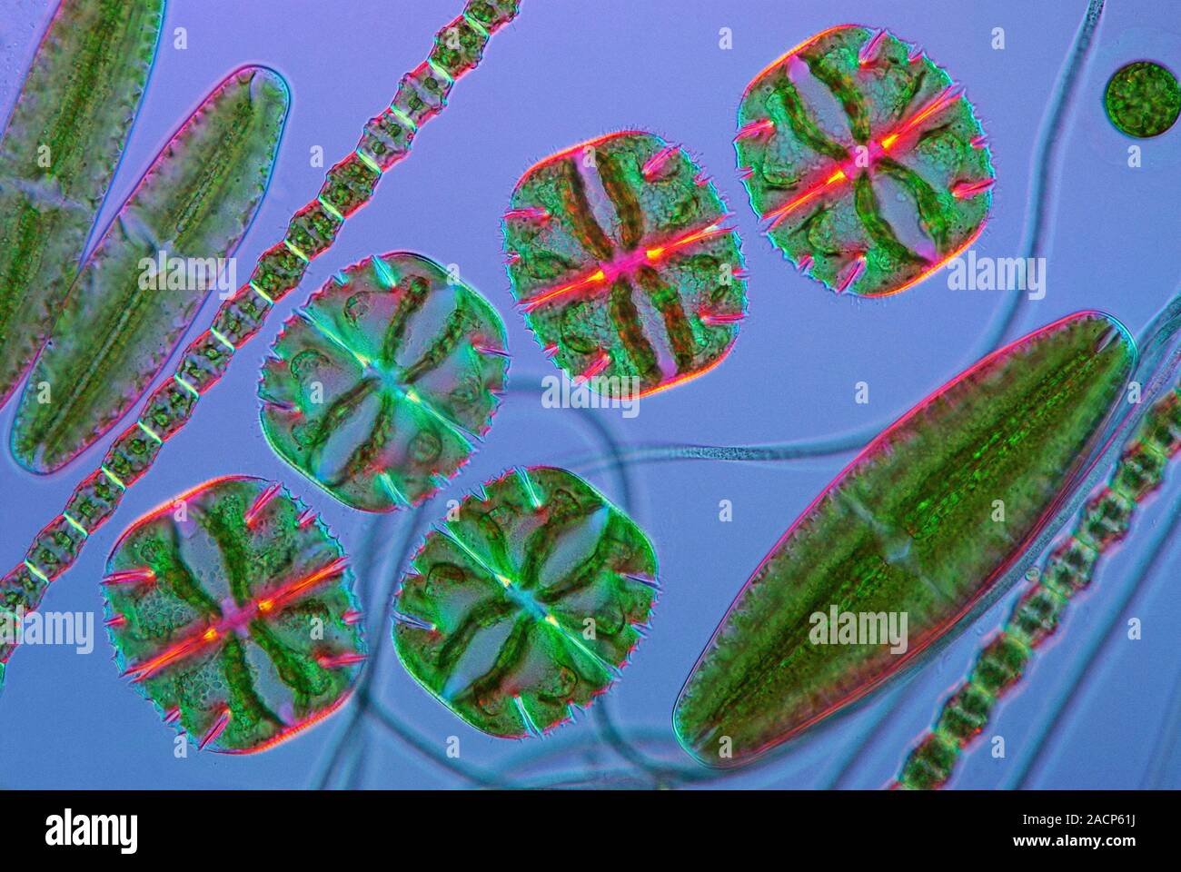 Desmids. Polarised light micrograph of various Micrasterias sp. and ...