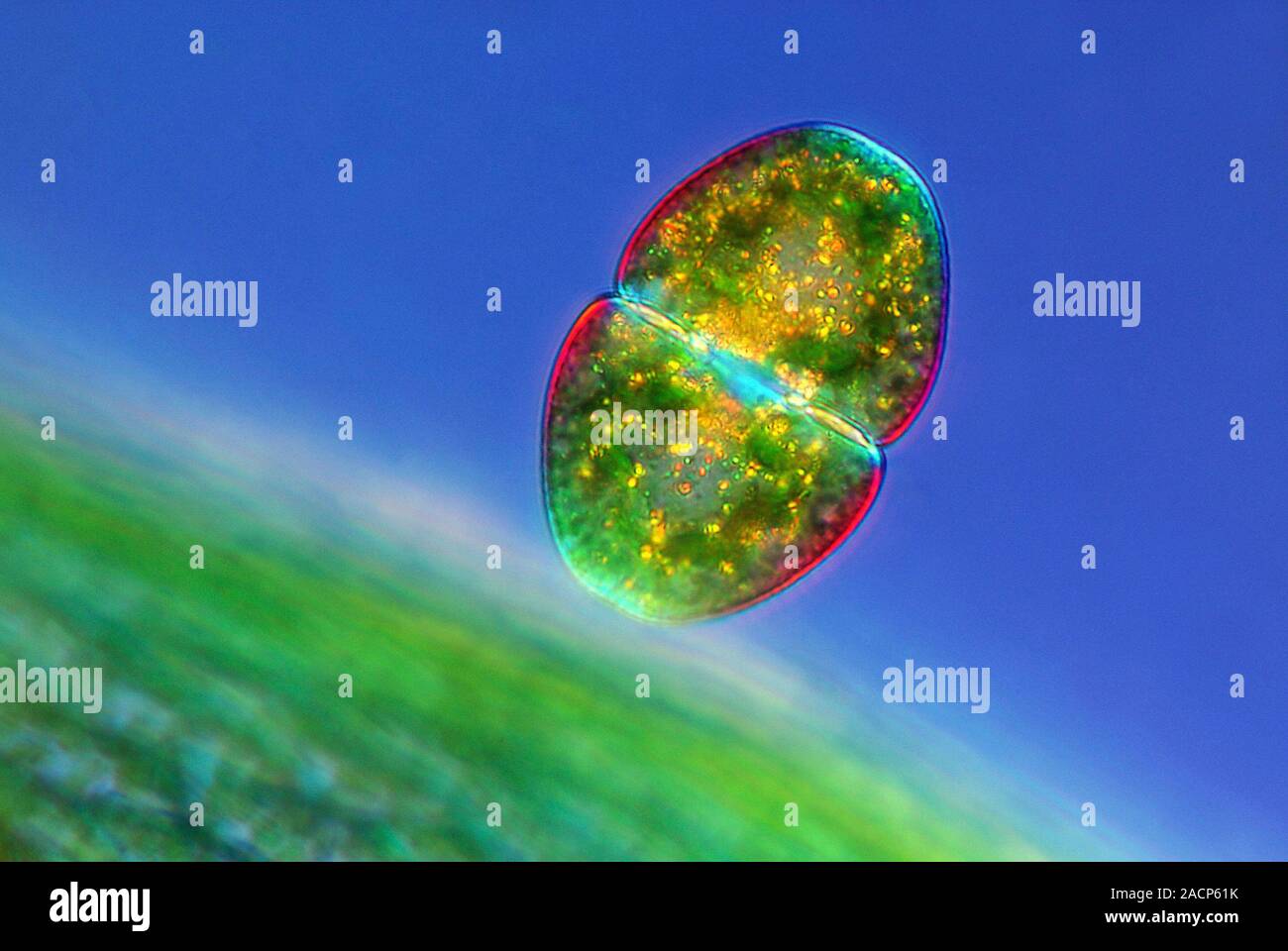 Cosmarium desmids. Polarised light micrograph of Cosmarium sp. desmid ...
