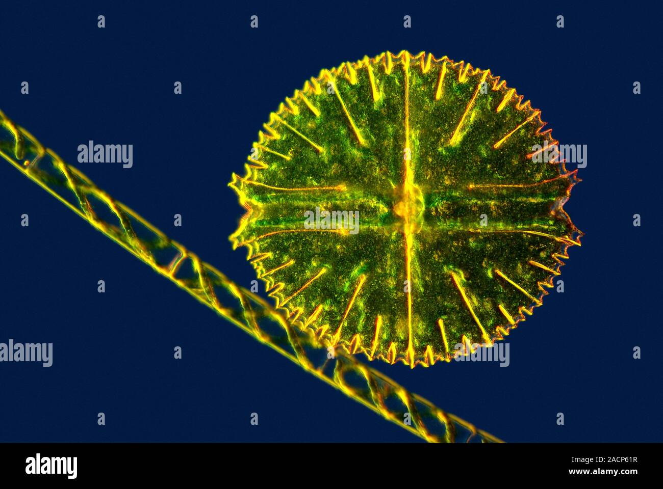 Green algae. Polarised light micrograph of Micrasterias rotata and ...