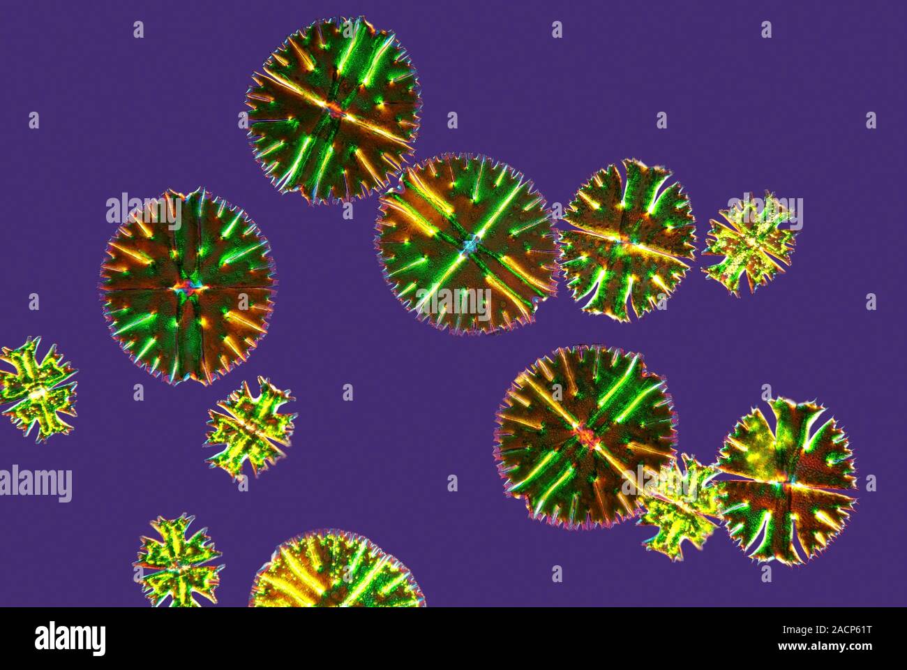 Micrasterias desmids. Polarised light micrograph of three species of ...