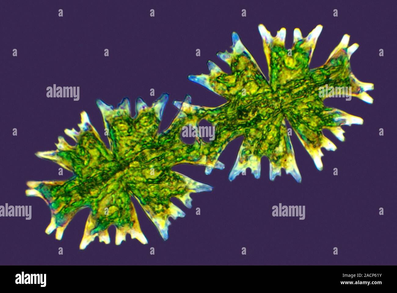 Micrasterias desmids. Phase contrast light micrograph of Micrasterias ...