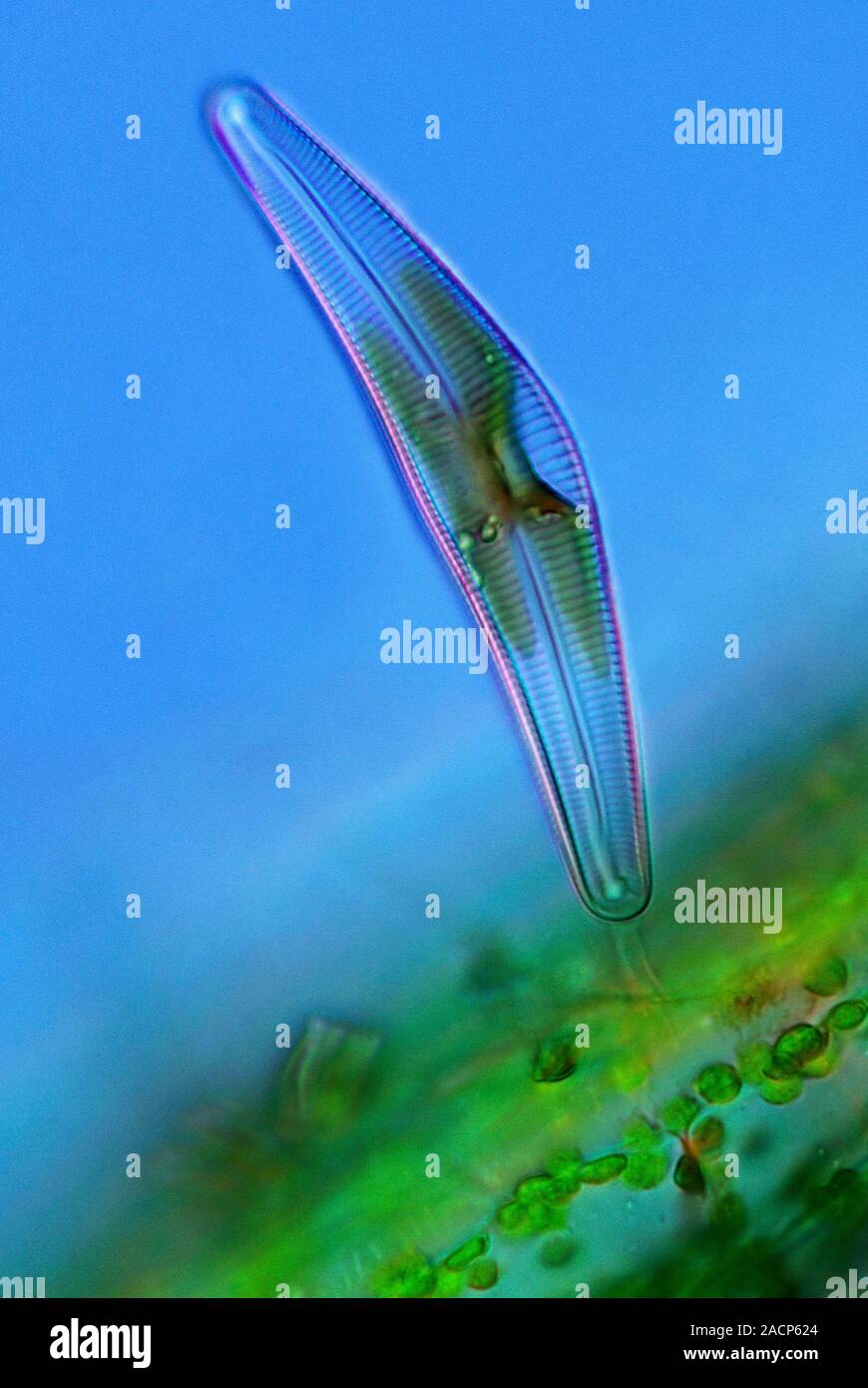 Diatom. Polarised light micrograph of a Cymbella sp. diatom. Diatoms ...