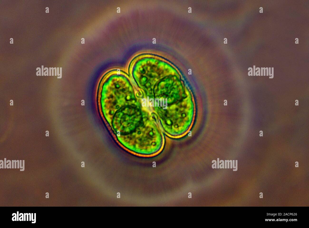 Cosmarium desmids. Phase contrast light micrograph of Cosmarium sp ...