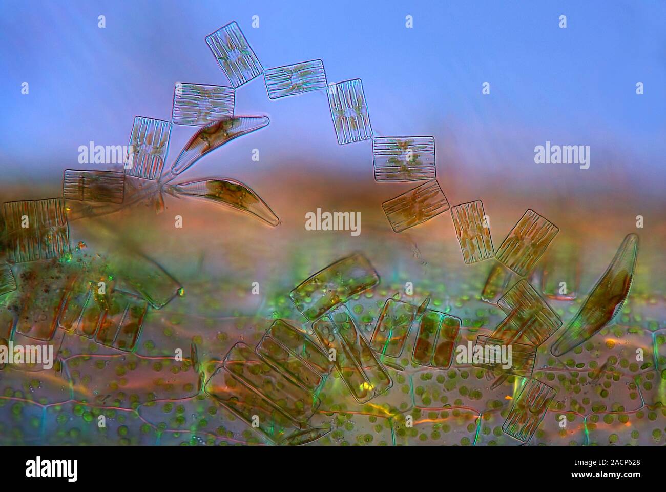 Diatoms. Polarised light micrograph of Cymbella sp. and Tabellaria sp ...