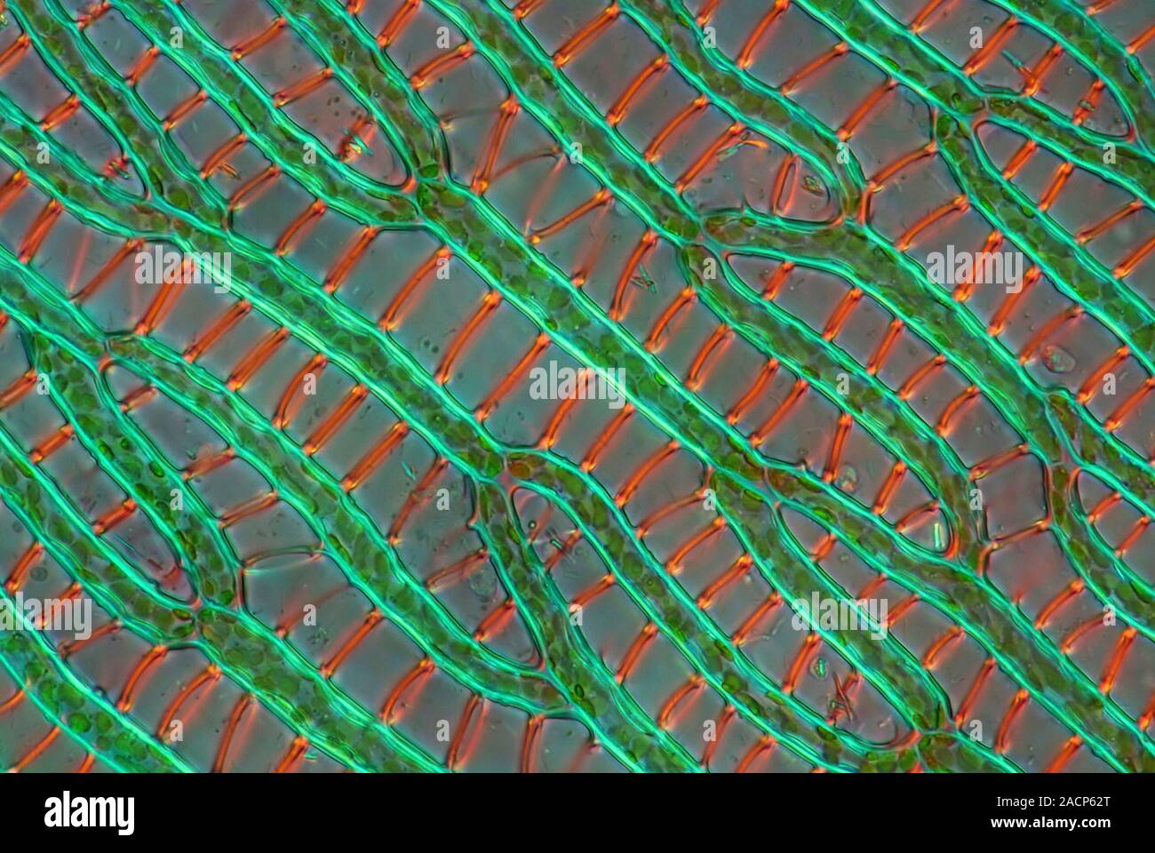 Sphagnum moss cells. Polarised light micrograph of a section through ...