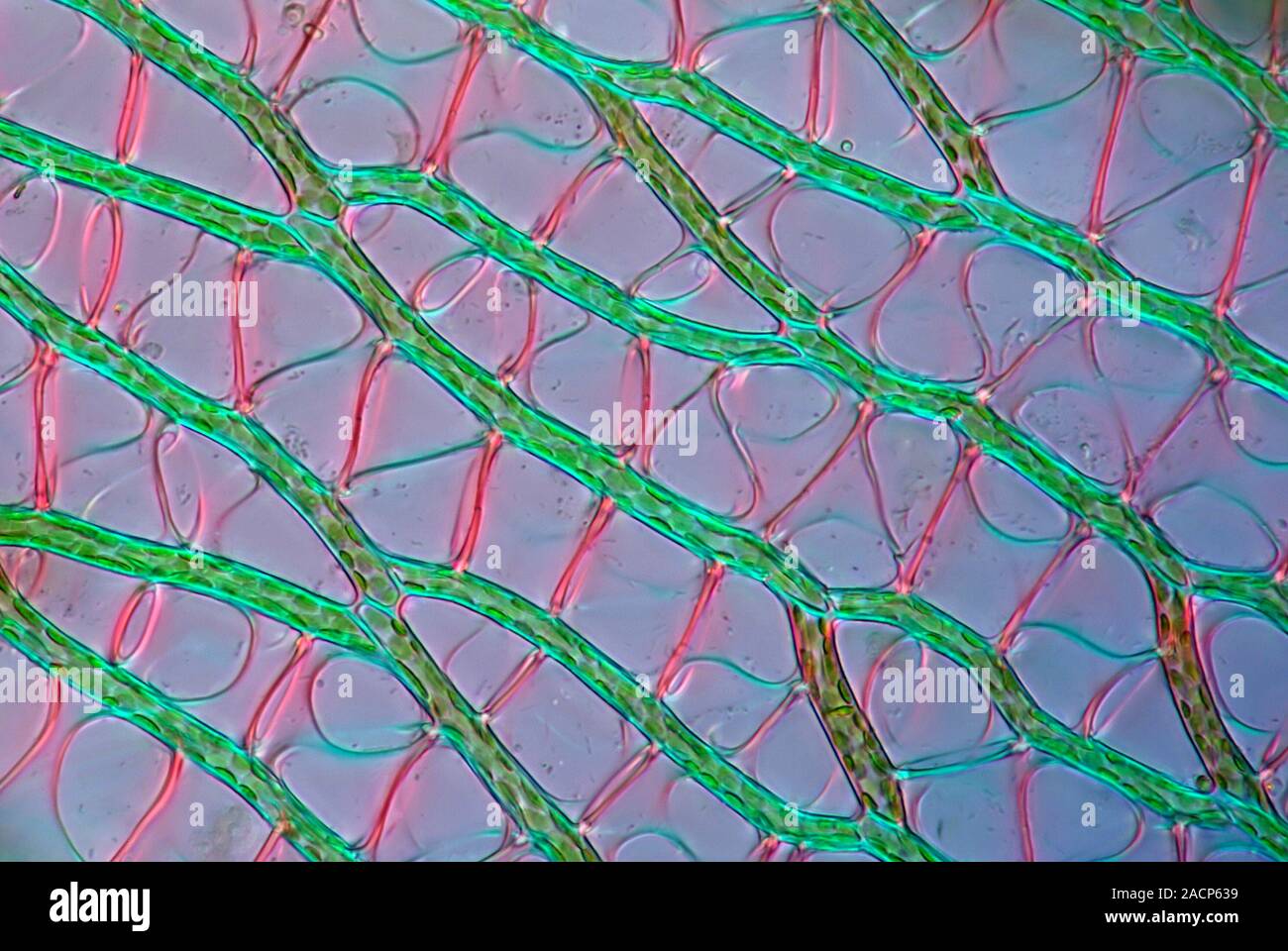 Sphagnum moss cells. Polarised light micrograph of a section through ...