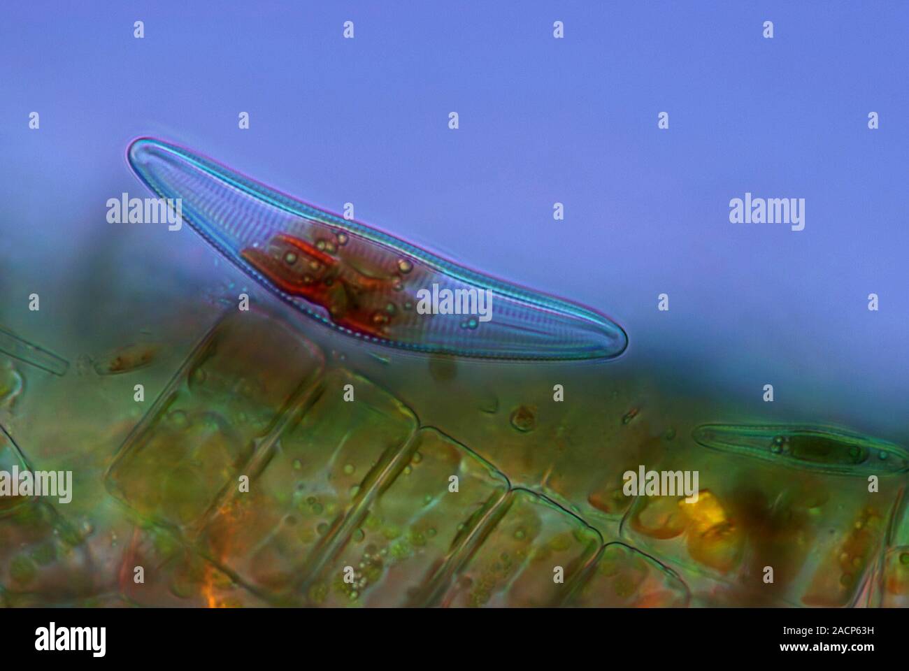 Diatoms. Polarised light micrograph of Cymbella sp. and Tabellaria sp ...