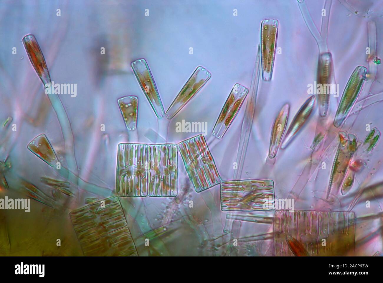 Diatoms. Polarised light micrograph of Tabellaria sp. and Gomphonema sp ...