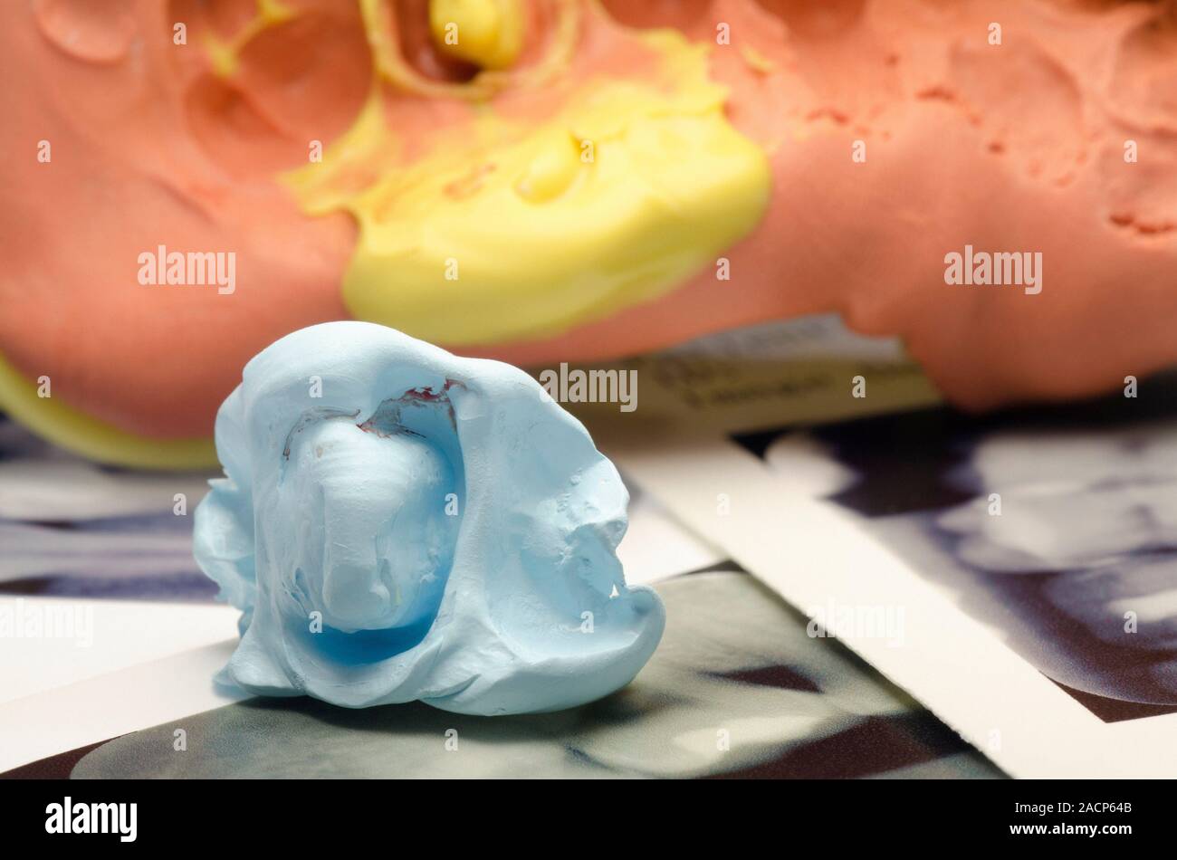Dental cast. Close-up of a cast of a human tooth Stock Photo - Alamy