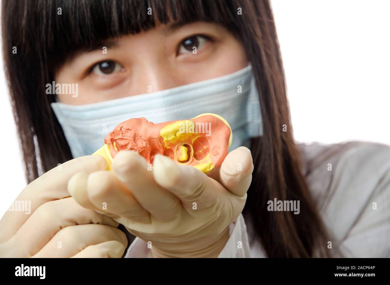 Dental cast. Close-up of a dentist holding a cast of human teeth Stock ...