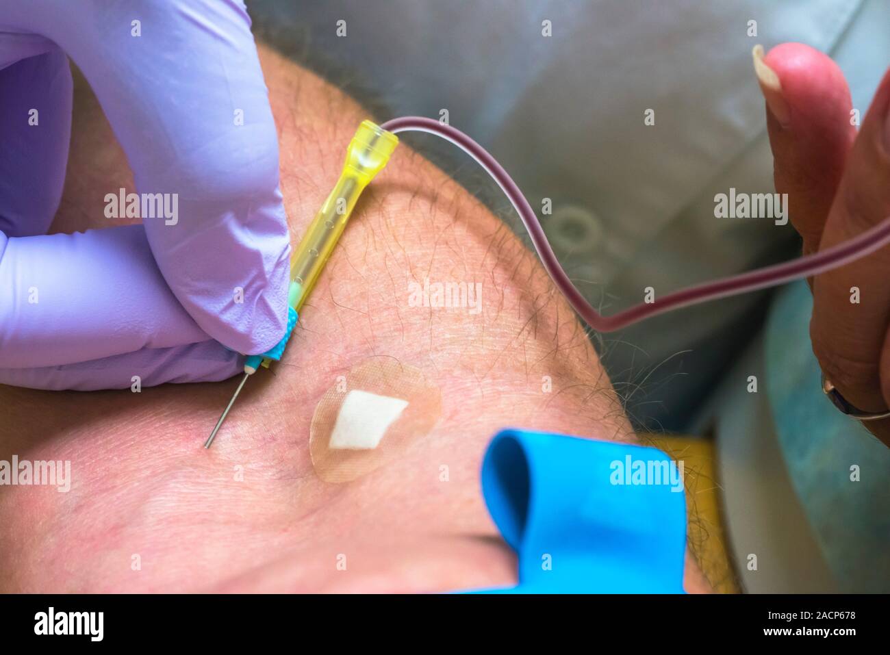 Blood sampling. Blood sample being taken from a patient's arm. The ...