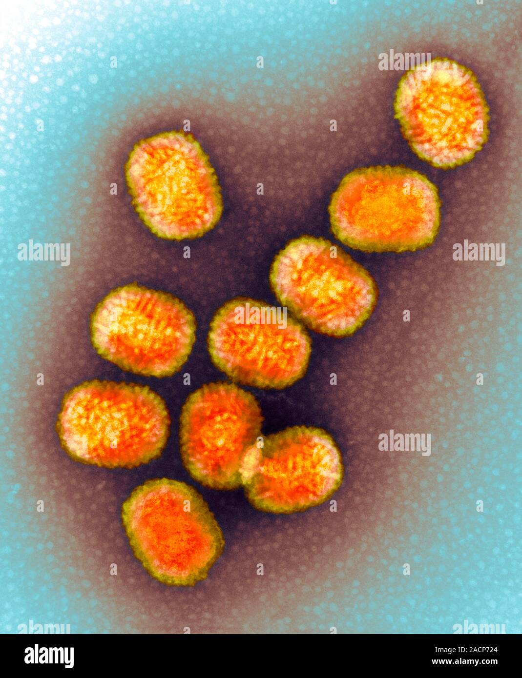 Molluscum contagiosum virus (MCV) particles, coloured transmission ...