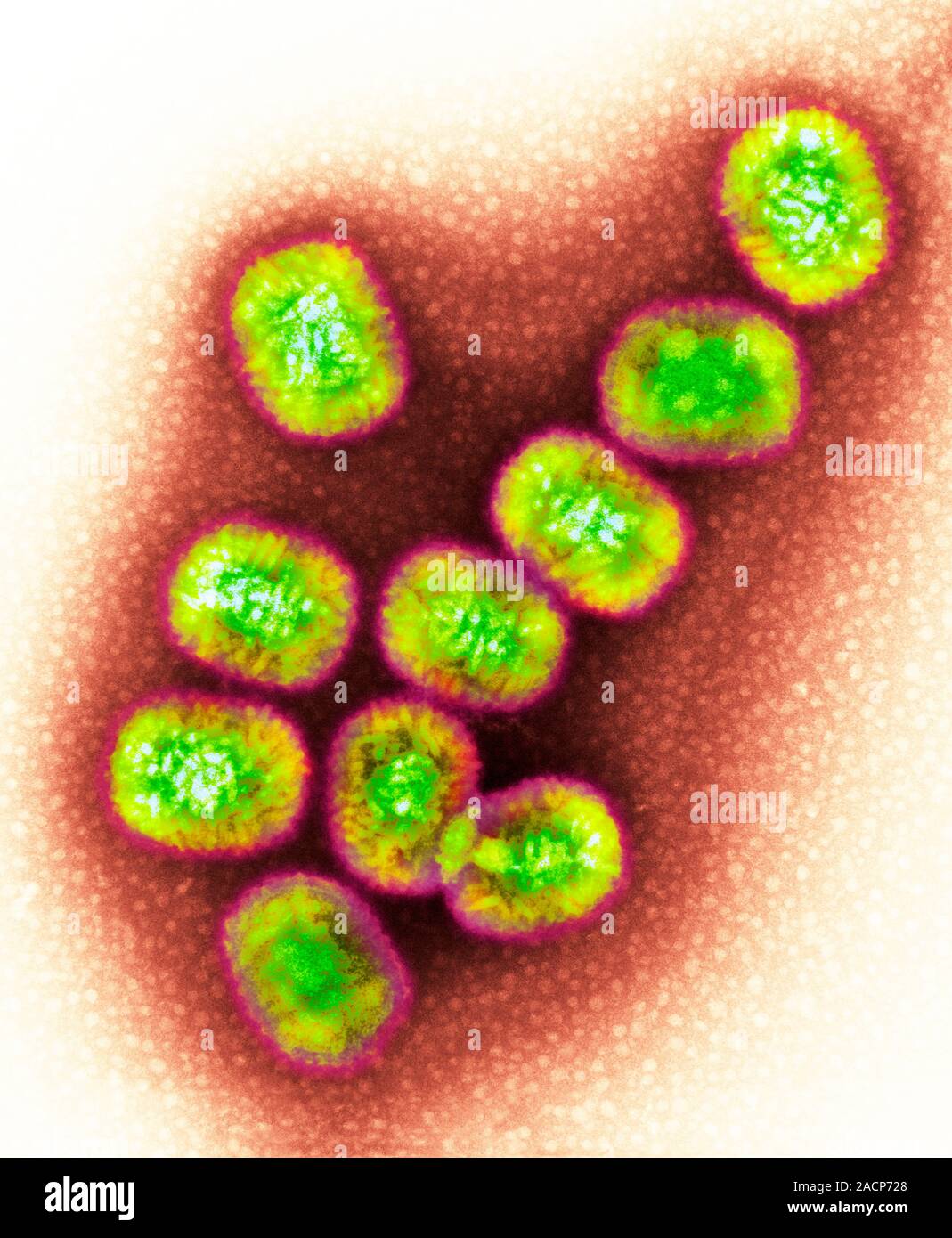 Molluscum contagiosum virus (MCV) particles, coloured transmission ...