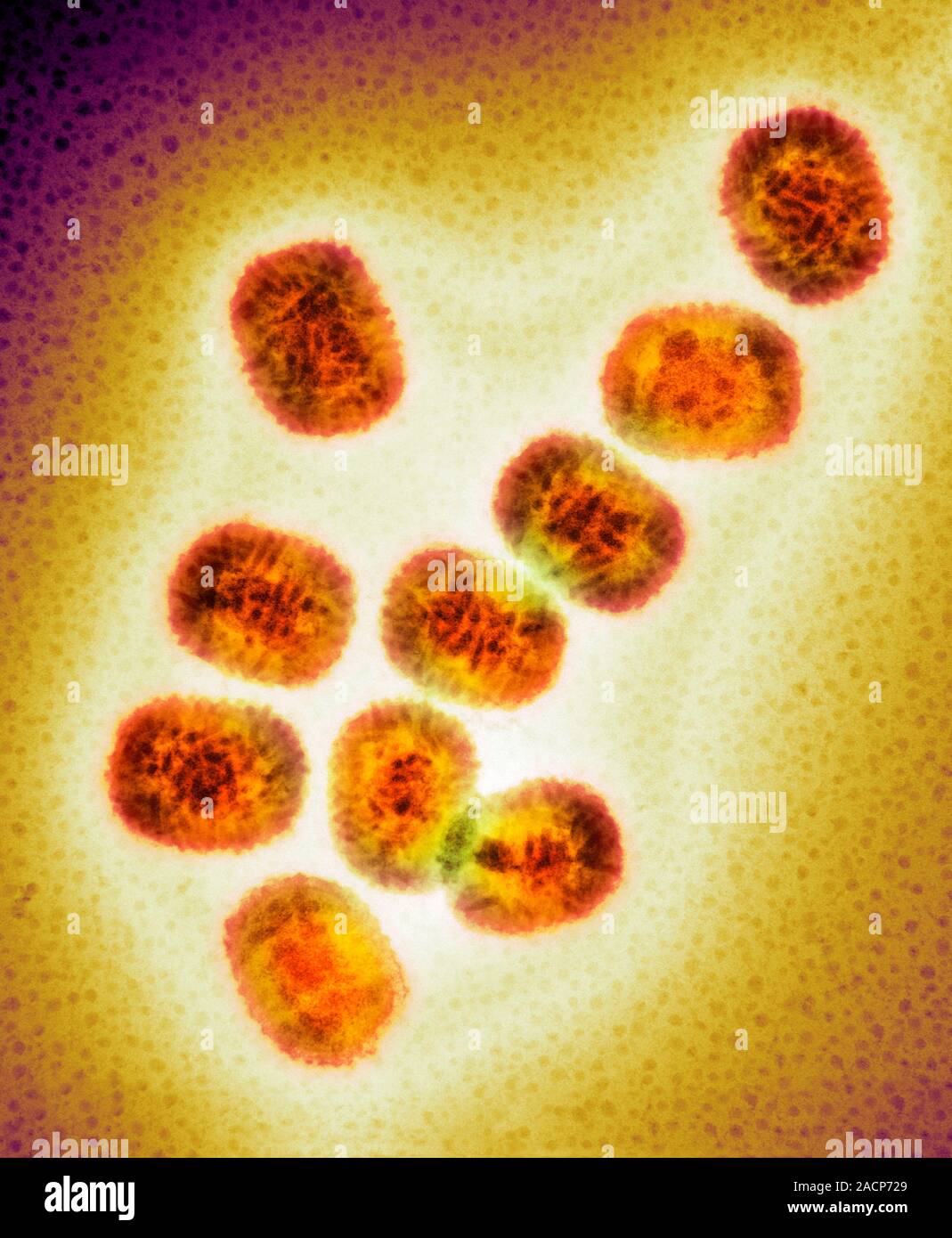 Molluscum contagiosum virus (MCV) particles, coloured transmission ...