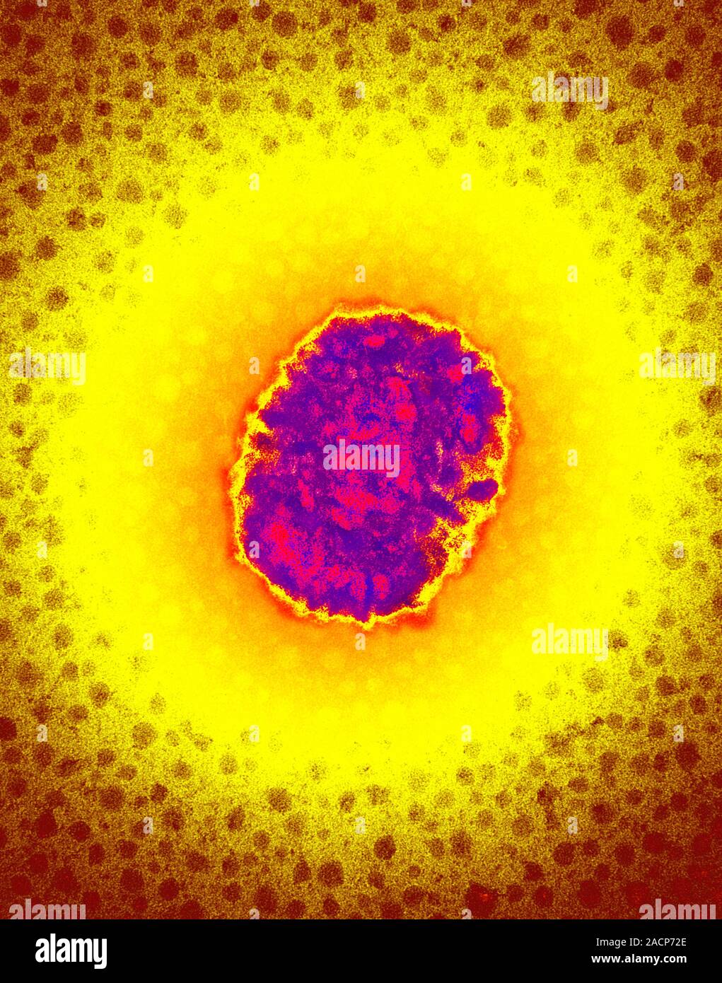 Molluscum contagiosum virus (MCV) particle, coloured transmission ...