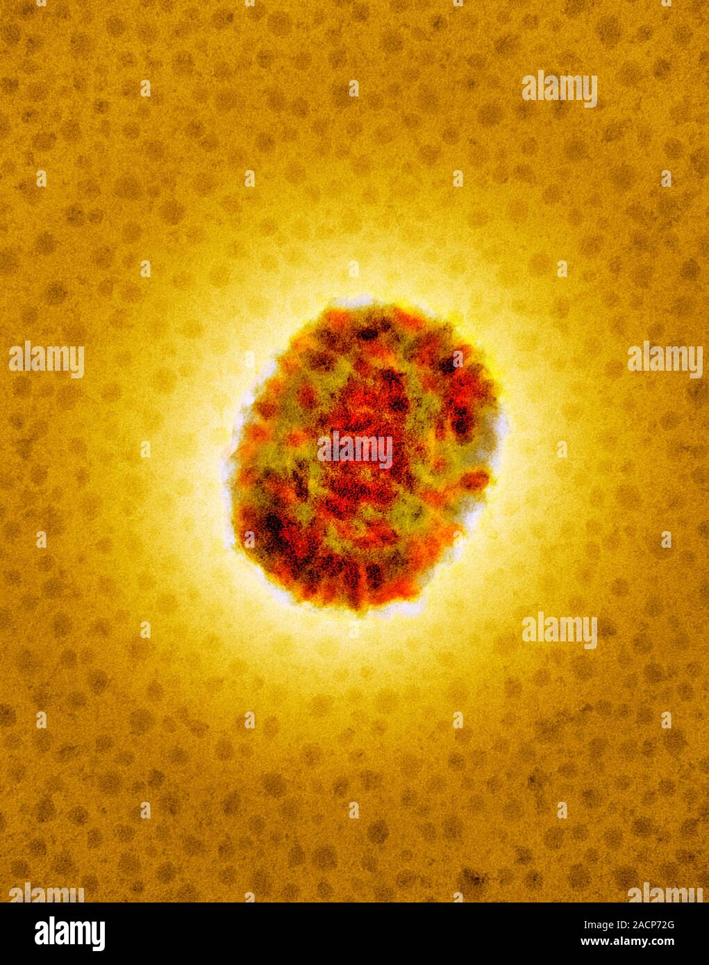 Molluscum contagiosum virus (MCV) particle, coloured transmission ...