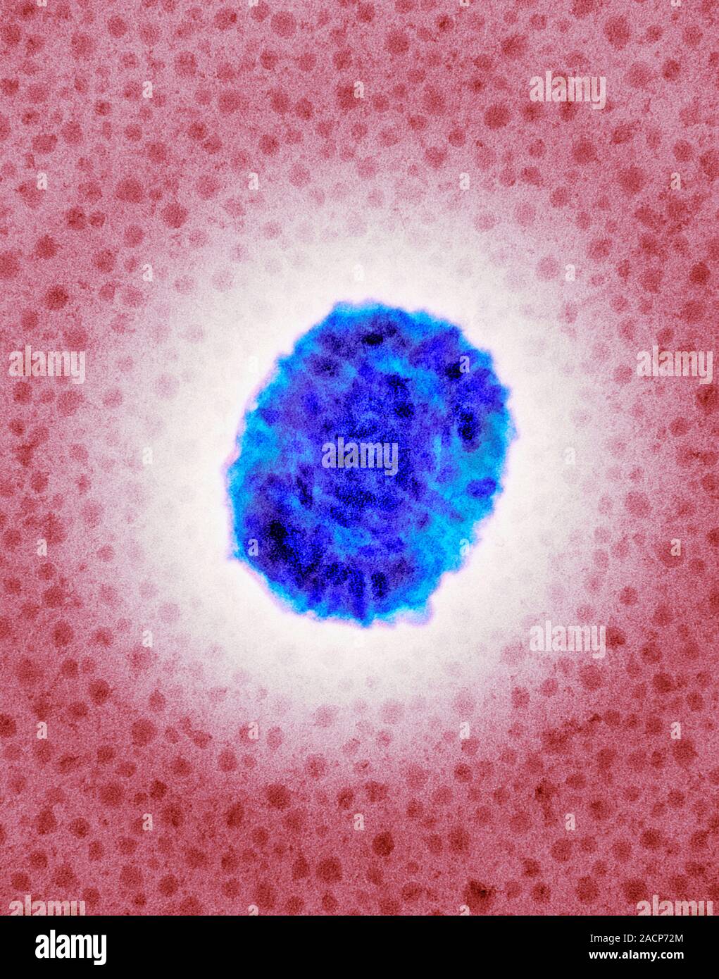 Molluscum contagiosum virus (MCV) particle, coloured transmission ...
