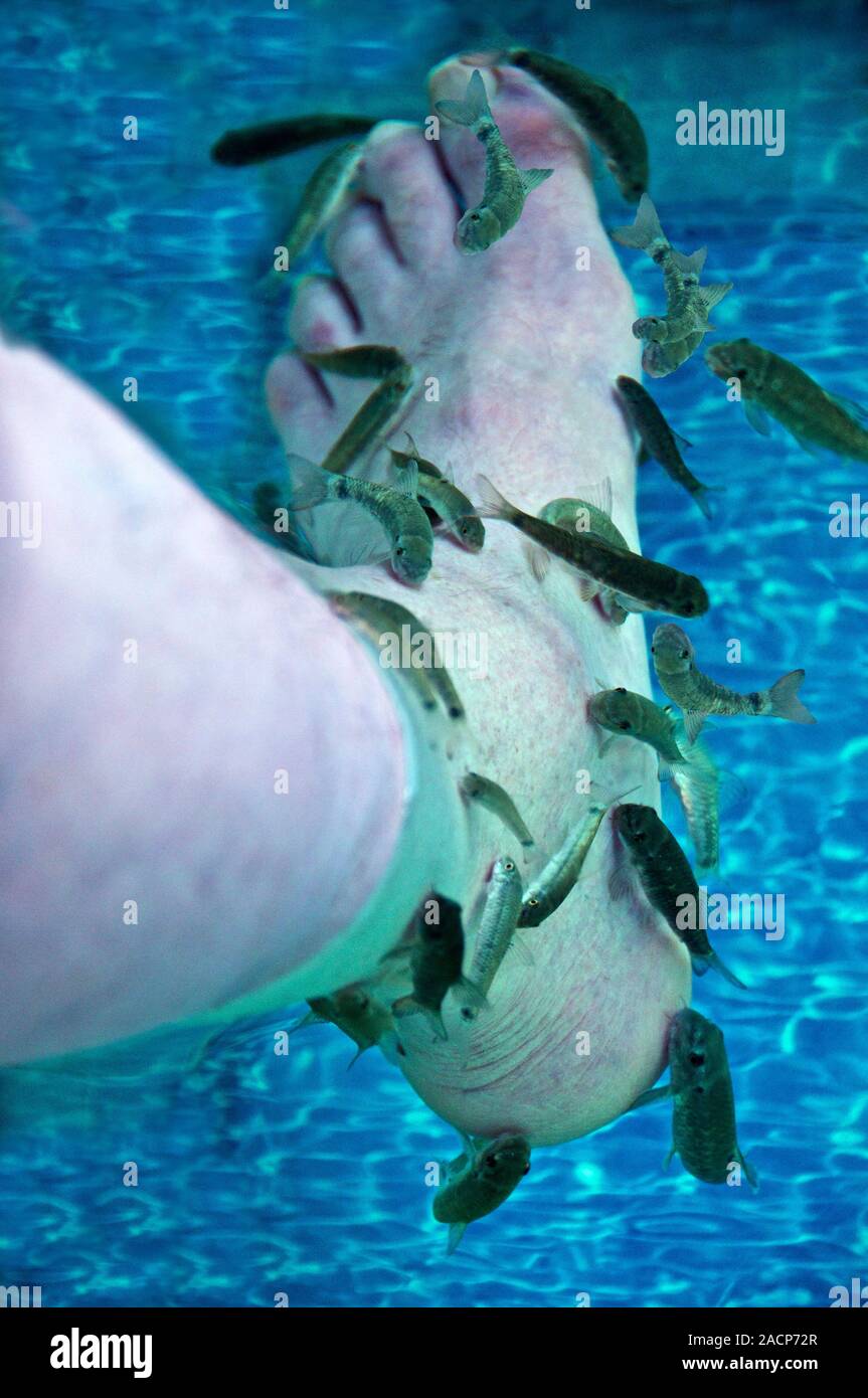 Fish pedicure. Doctor fish (Garra rufa) feeding on the dead skin on a ...