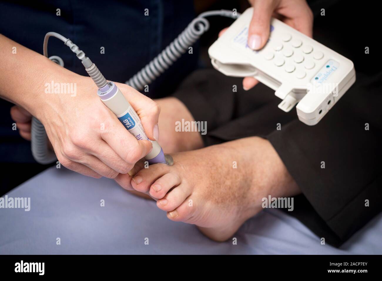Diabetes clinic, ultrasound foot scan. Doppler ultrasound scan being ...