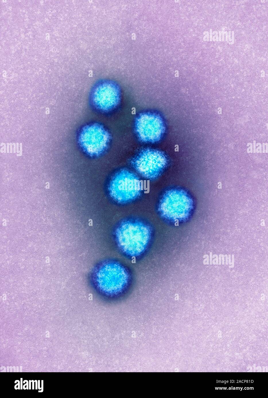 Schmallenberg virus. Transmission electron micrograph (TEM) of virus ...