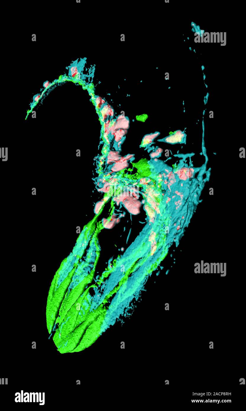 C. elegans worm. Confocal laser scanning micrograph of a Caenorhabditis ...