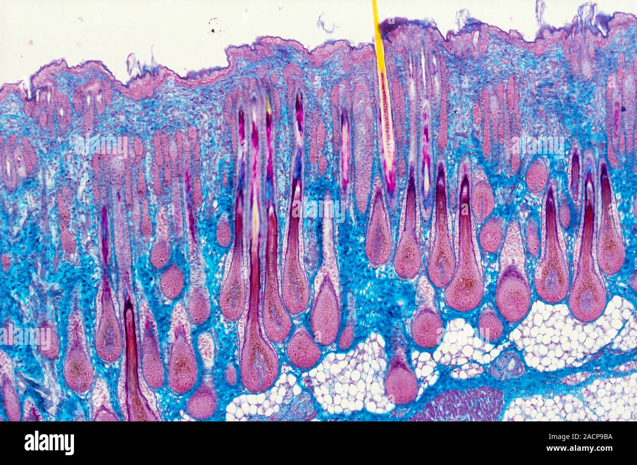 Hairy scalp skin. Light micrograph of a section through healthy skin ...