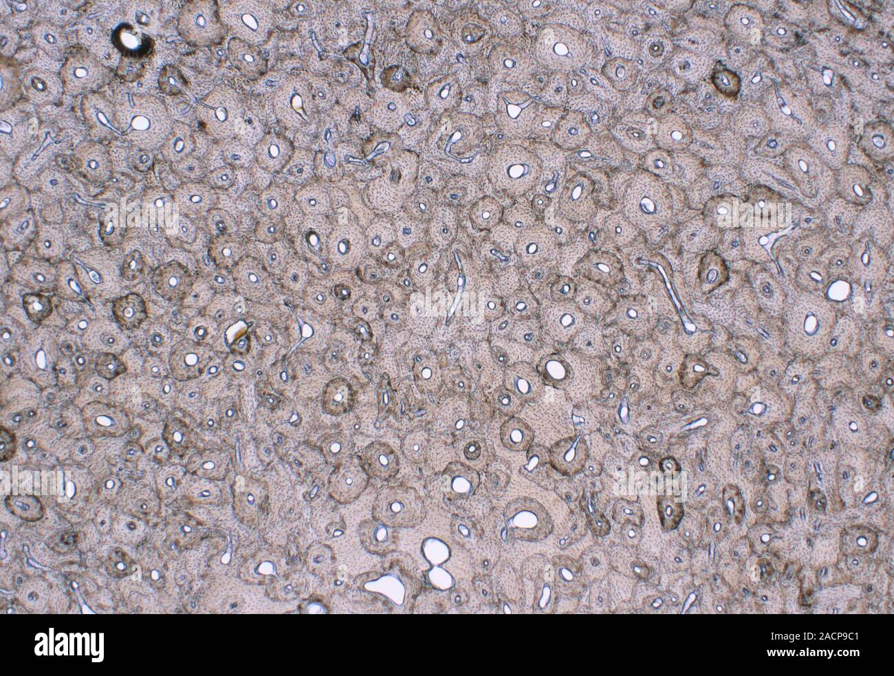 Bone tissue. Light micrograph of a section through adult compact bone ...
