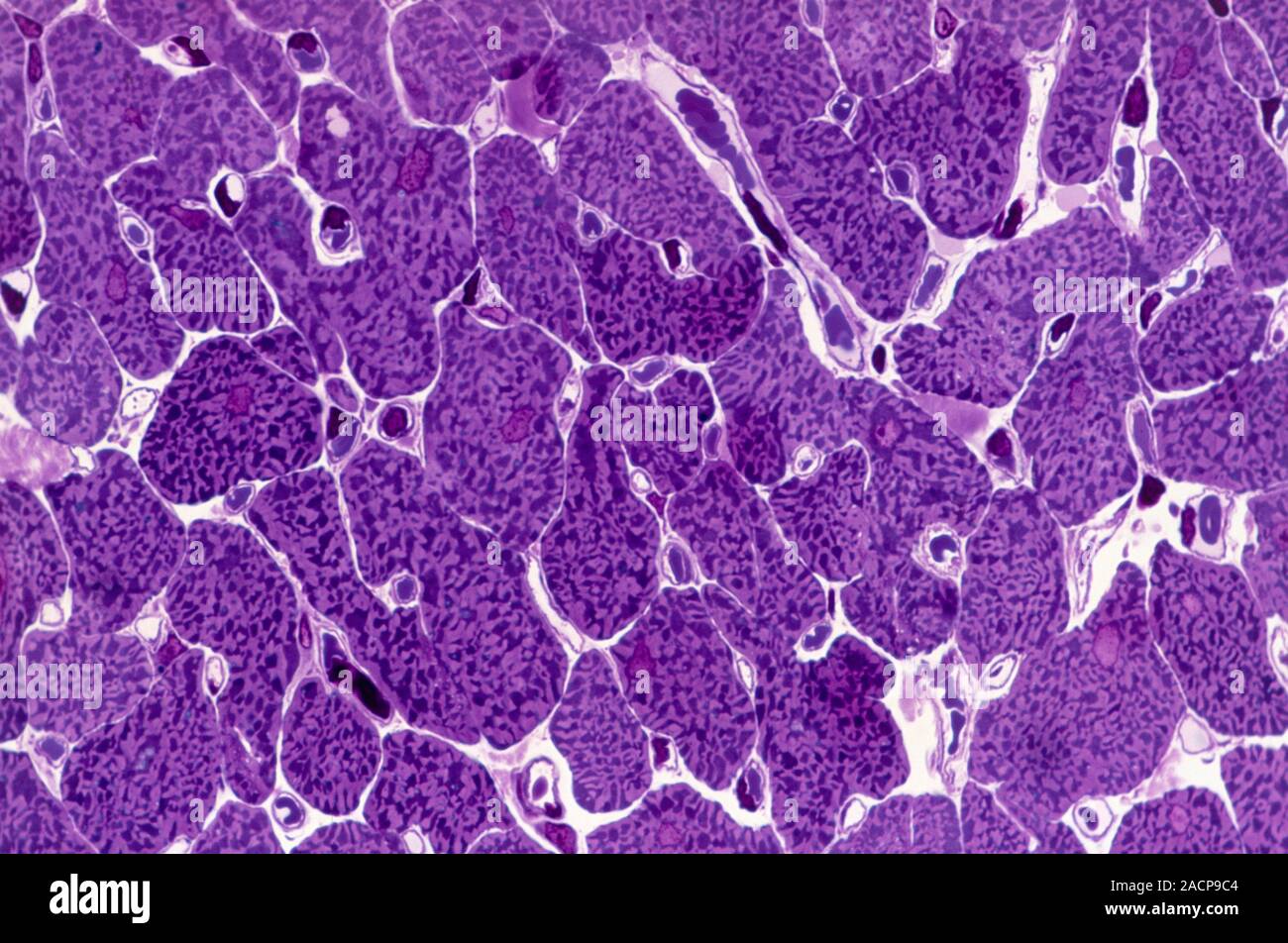 Cardiac muscle. Light micrograph of a section through muscle tissue ...
