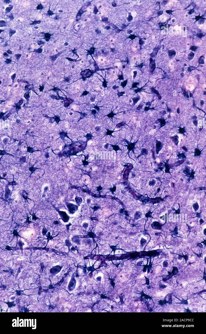 Glial cells in the brain. Light micrograph of a section through glial ...