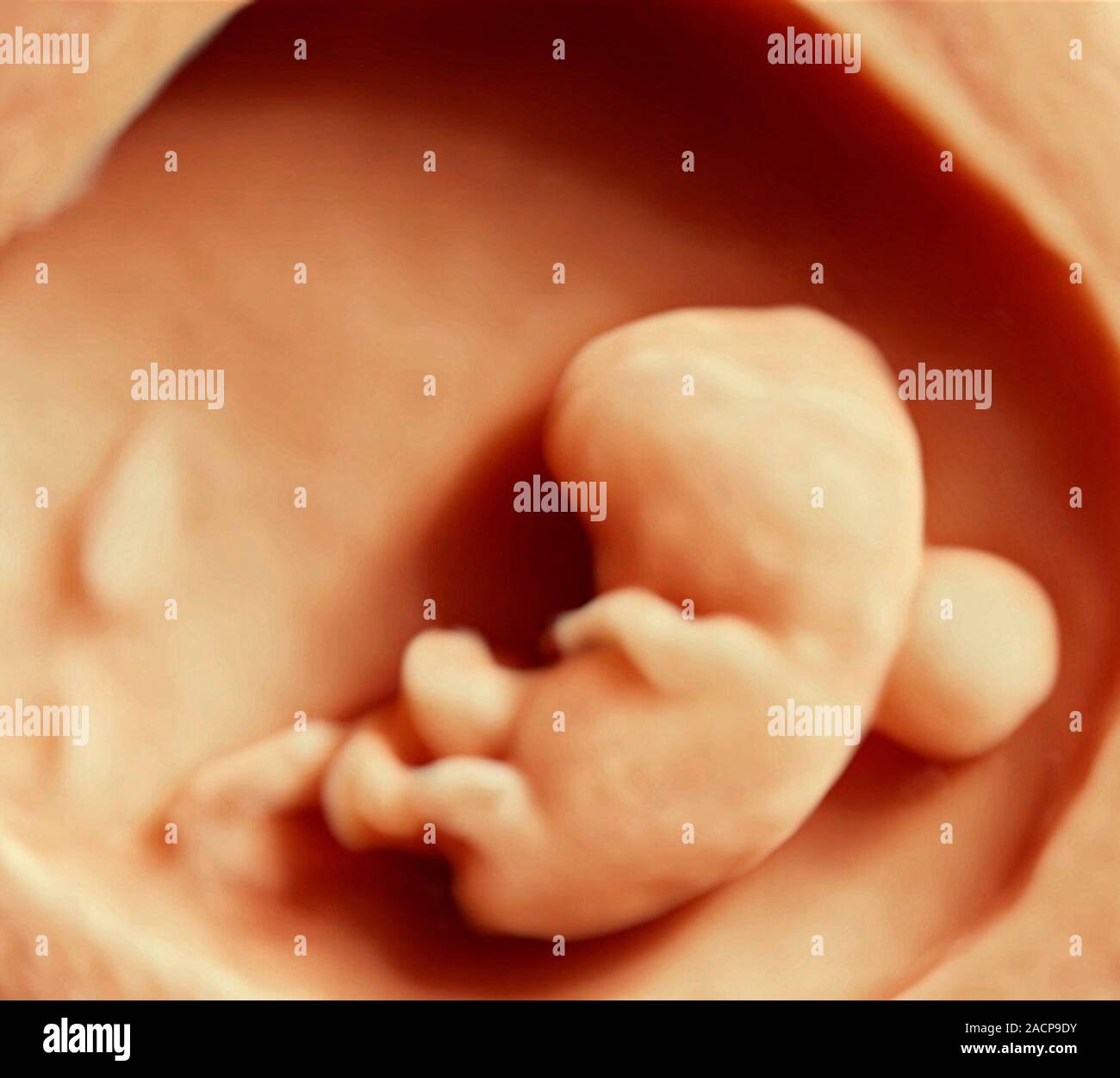 6 week foetus, 3-D ultrasound scan. Three-dimensional (3-D) ultrasound ...