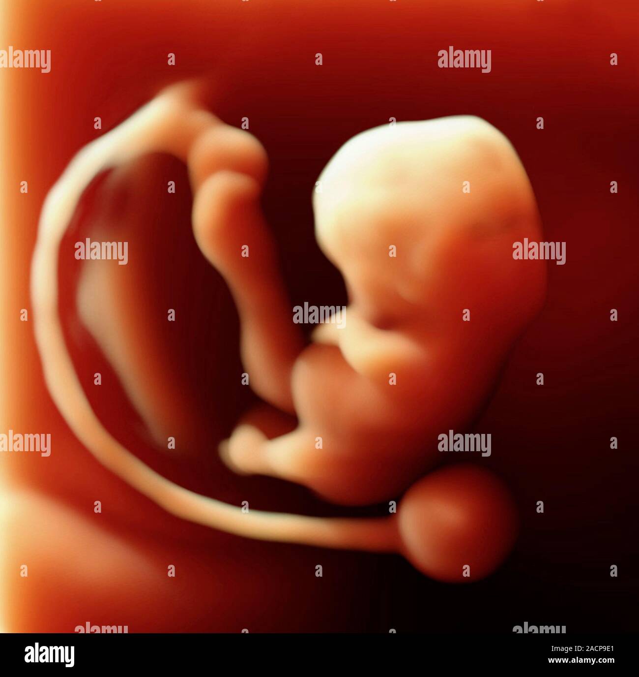 6 week foetus, 3-D ultrasound scan. Three-dimensional (3-D) ultrasound ...