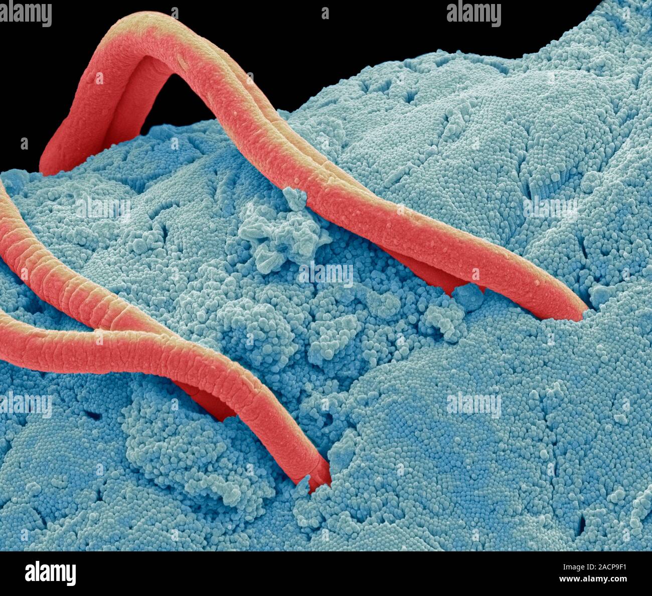 Threadworms in the gut. Coloured scanning electron micrograph (SEM ...